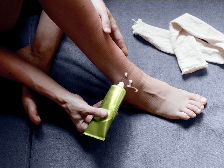 Tacrolimus for eczema: Effectiveness and more