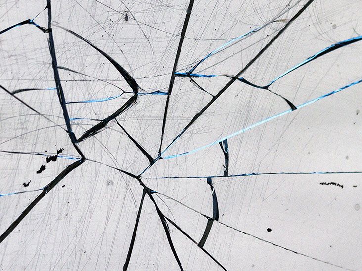 Sacral fracture symptoms and treatments