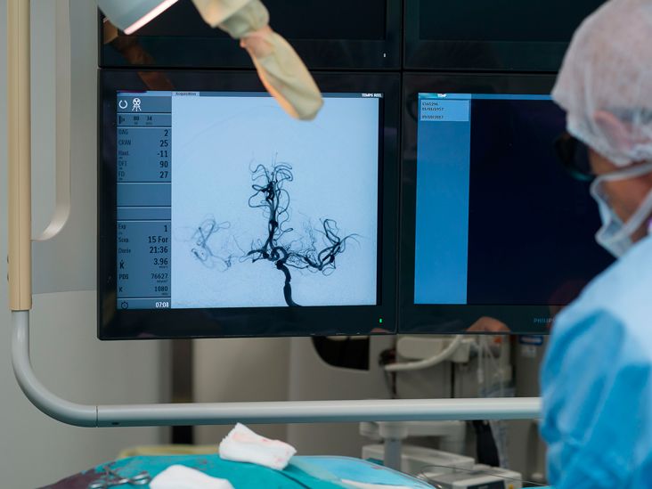 TIA vs stroke: Definitions, causes, symptoms, and more