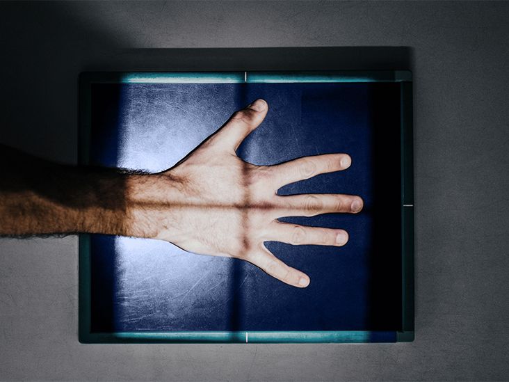 Bone cancer and X-rays: Appearance and next steps