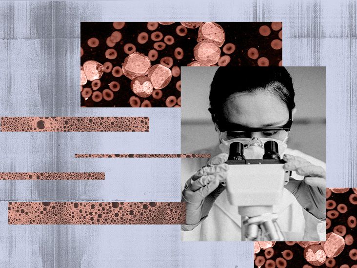 What tests can diagnose and stage AML?