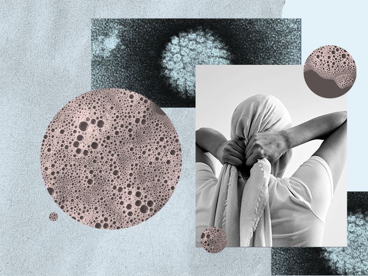 Cancer and HPV: Types, prevention, and more