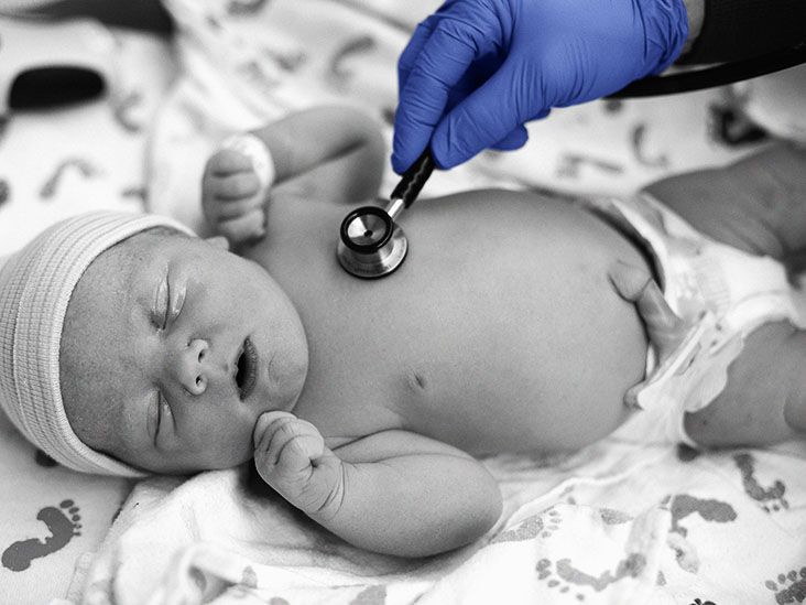 Congenital Heart Defects Babies