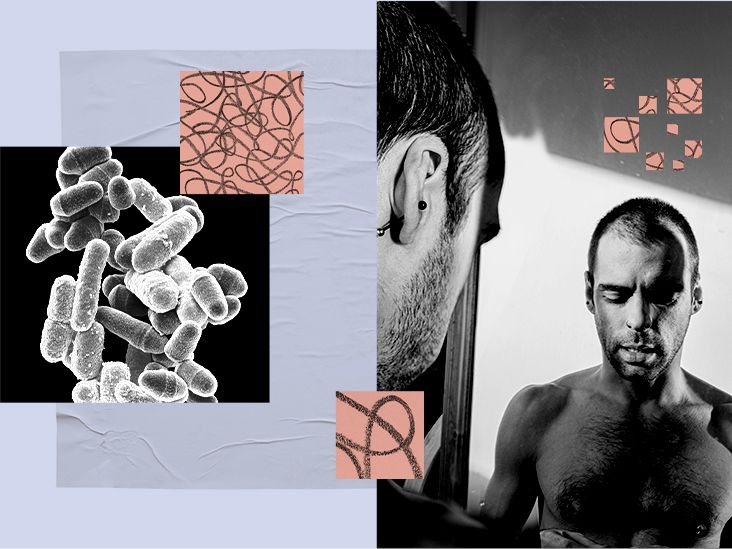 Probiotics for bipolar: Does it help?