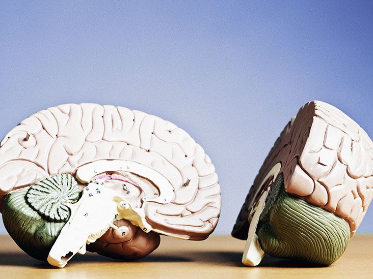 Right side stroke: Symptoms, possible effects, and more