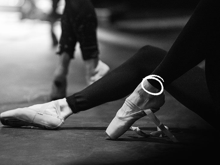 Ankle bursitis: Symptoms, causes, and treatment