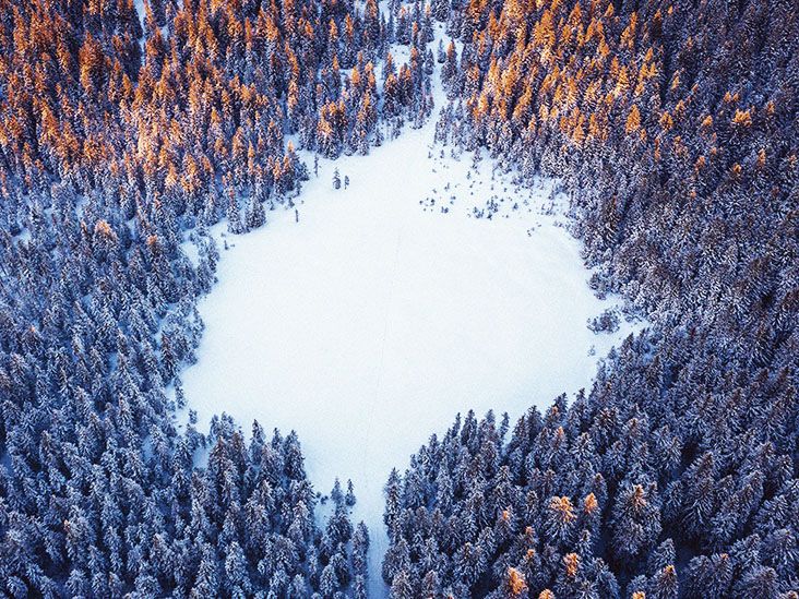 Annular psoriasis: Definition, symptoms, causes, and more