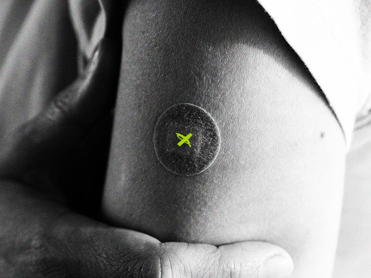 Hepatitis A vs. B: Differences, similarities, and prevention