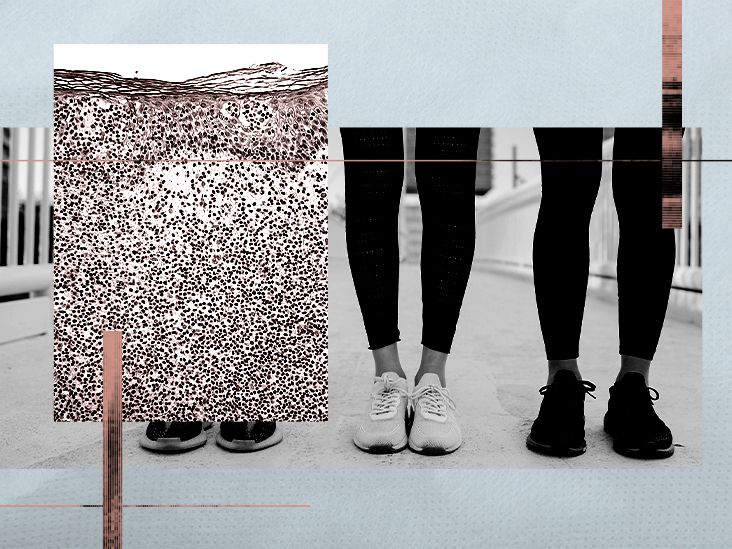 Symptoms of non-Hodgkin lymphoma in females: What to know