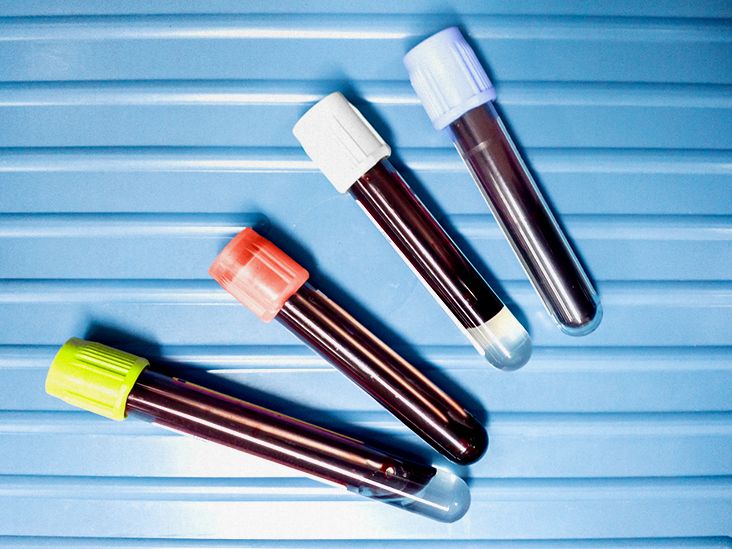 Leukemia platelet counts: Levels and more