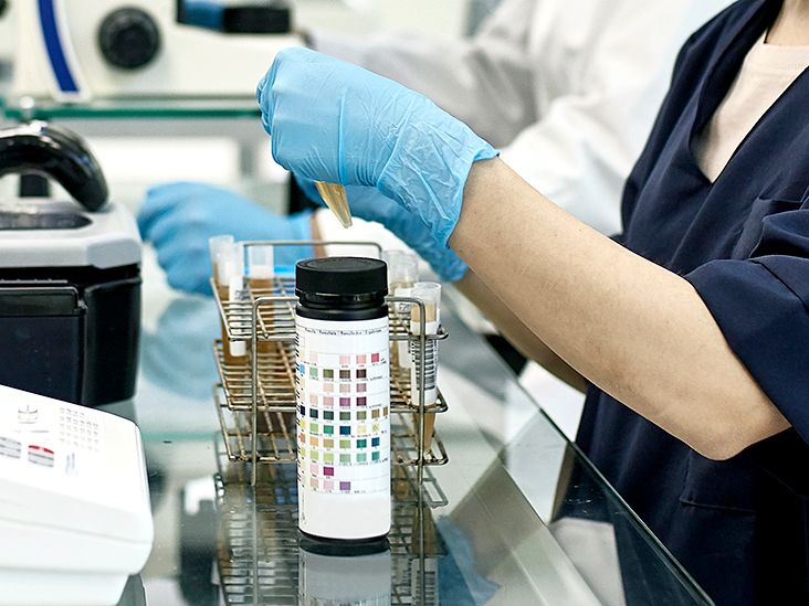 Pancreatic and prostate cancer: Simple urine test may aid diagnosis