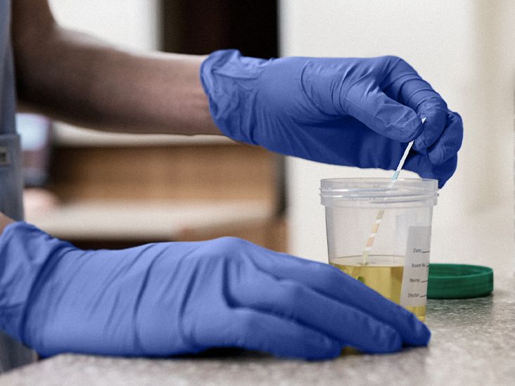 Bladder cancer: Test may help predict disease years before symptoms