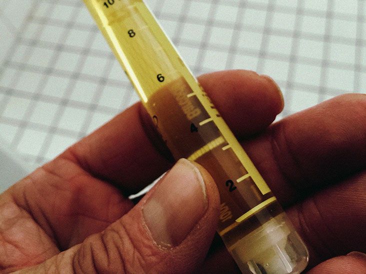 Screening for kidney cancer: For those with average and high risk