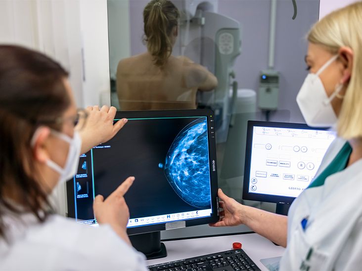 Breast cancer detection: 3D mammogram better than 2D scan, study finds