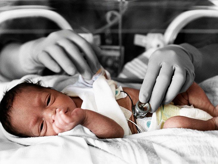 Stroke in fetuses or newborns