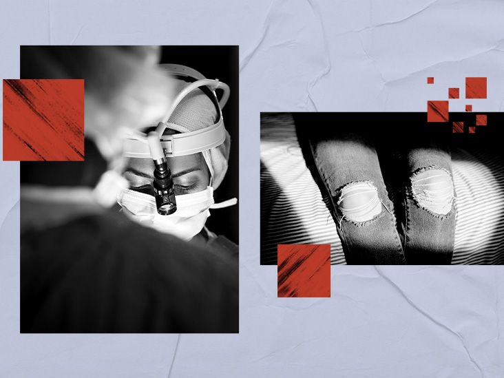 ACL reconstruction surgery: Procedure, preparation, recovery, and more