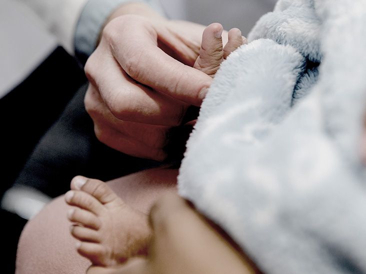 Acrodermatitis enteropathica: Causes, symptoms, outlook, and more