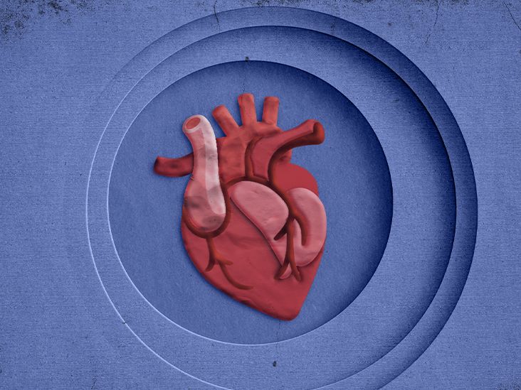 AFib and an enlarged heart: Link, other causes, and outlook