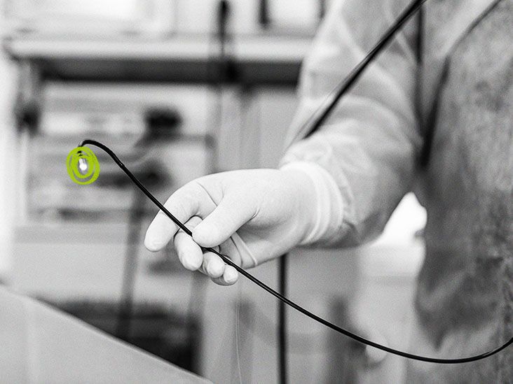 Colon polyp size chart: How doctors classify polyps