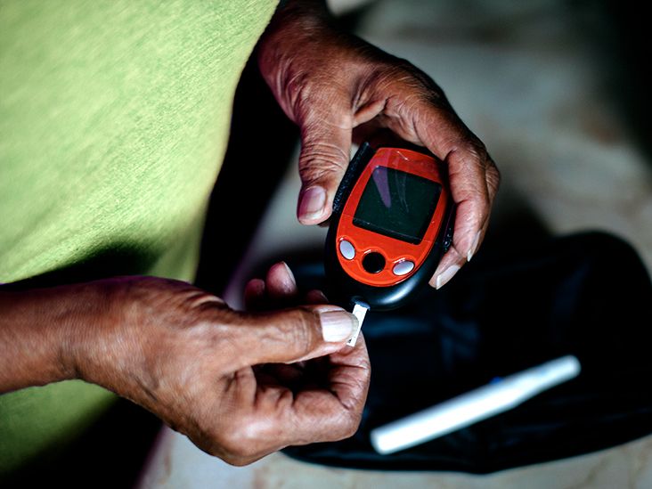 How type 2 diabetes changes over time: Progression and outlook