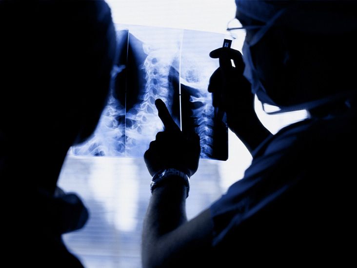 Bone demineralization and osteoporosis: Differences explained