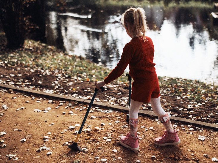 What is spastic diplegia cerebral palsy?