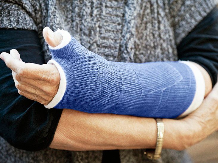 Symptoms of osteoporosis: Early and late stage signs