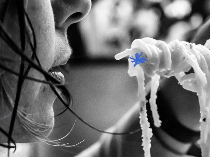 Aerophagia: Causes and treatment