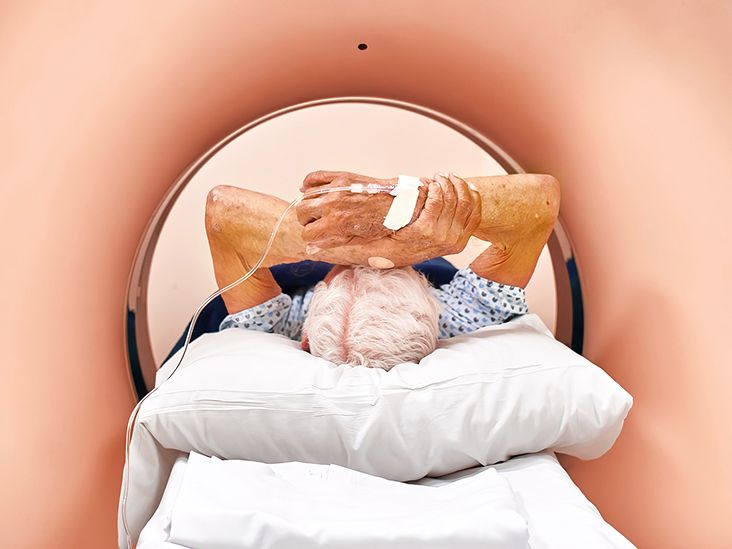 PSMA PET test for prostate cancer: Definition, uses, and more