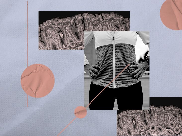 Hyperplastic polyp in colon: Causes, treatment, and outlook