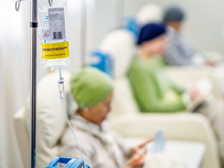 5-FU chemo: Side effects and more