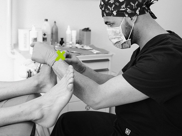 Gout vs bunion: Symptoms, causes, treatment, and more