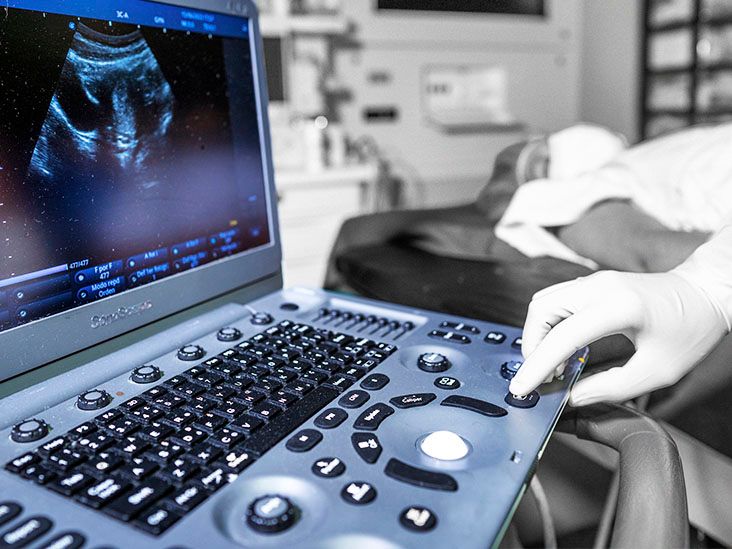 Hemorrhagic ovarian cyst: Causes, symptoms, and more