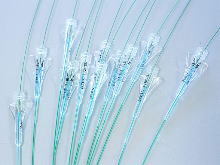 Heart angioplasty and stent placement: Procedure, risks, and recovery