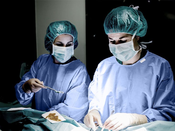 Surgery for GISTs: Procedures and FAQs