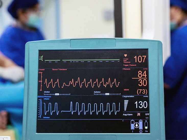 Can an EKG detect heart attacks?