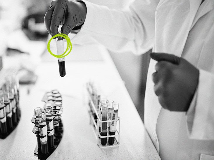 Hepatitis B (or hep B) screening: What to know