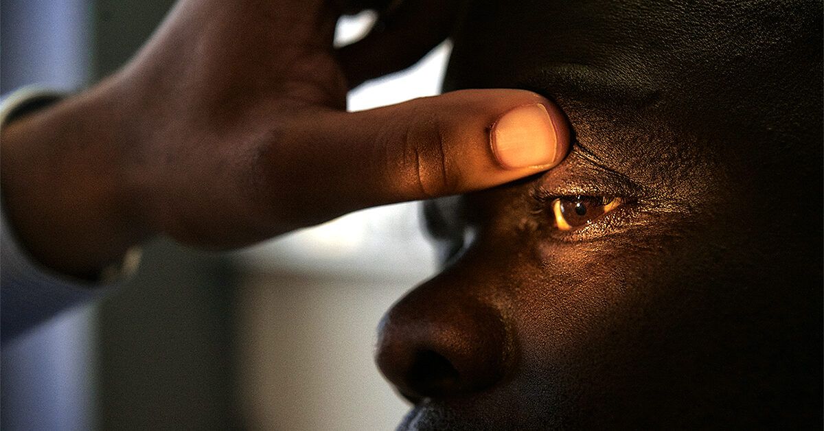 Geographic atrophy progression and outlook