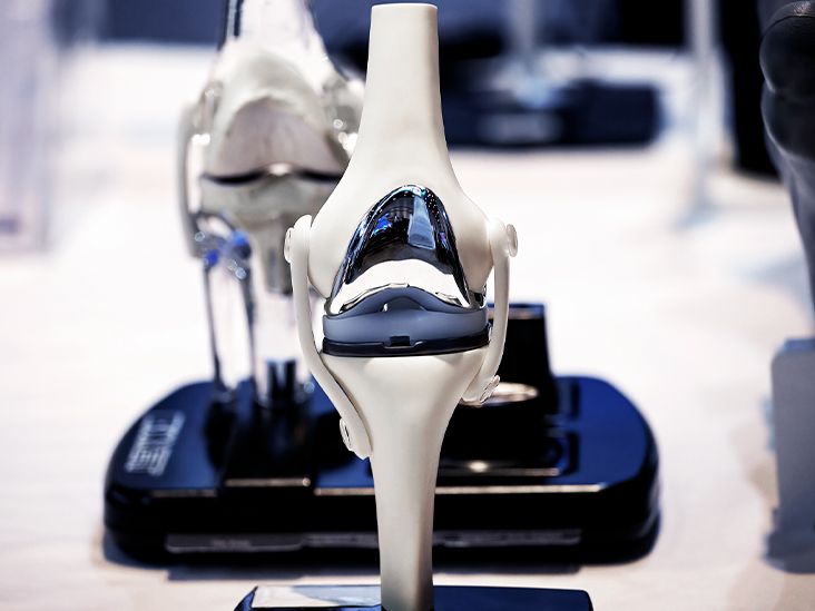 Types of knee replacement