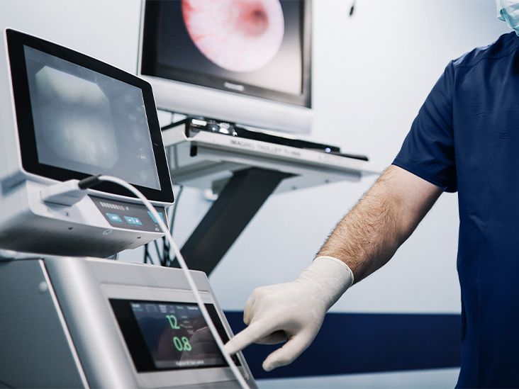 Colorectal cancer: Can AI be used for a colonoscopy?