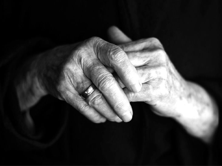 Acrodermatitis continua of Hallopeau: Everything to know