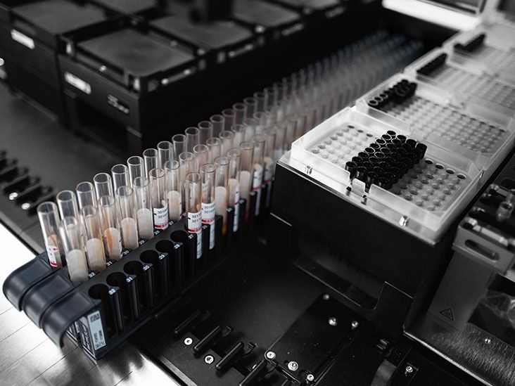 What is a C-Reactive Protein (CRP) Test: Results and more