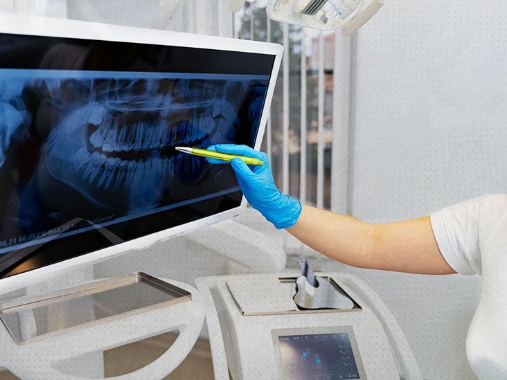 Oral cancer prevention: Lowering the risk and early symptoms