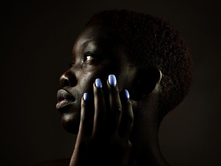 What causes shingles to activate? Possible triggers and more