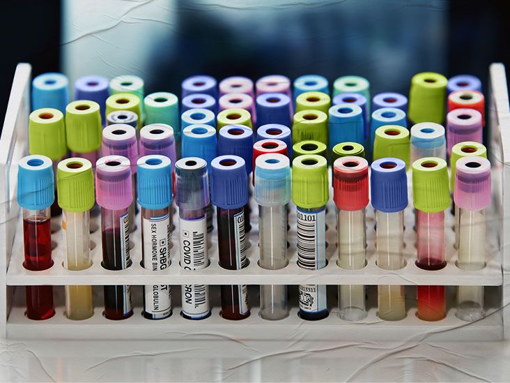 Lab tests for hemophilia: Results and other tests