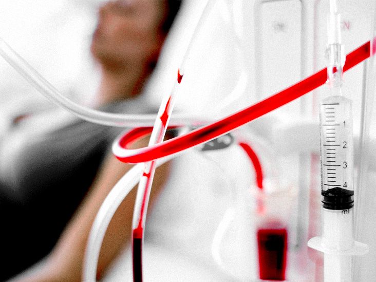 Dialysis: Side effects, overcoming them, and when to seek help