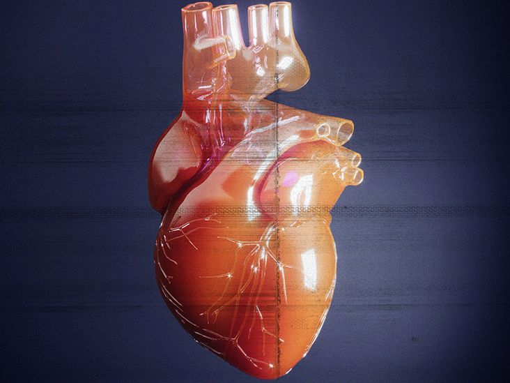 Septal Infarct Causes Symptoms And Diagnosis
