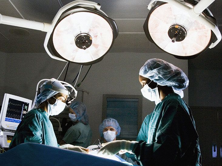 Internal Surgical Staples