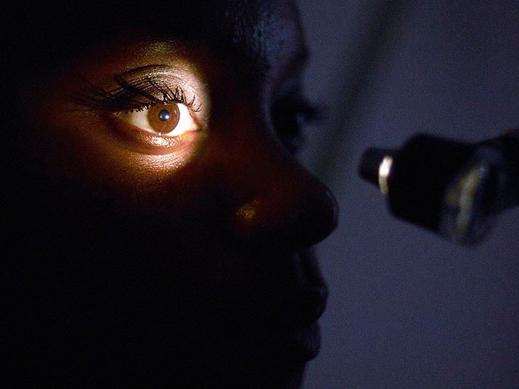 Cortical cataracts: Symptoms, causes, treatment, and more