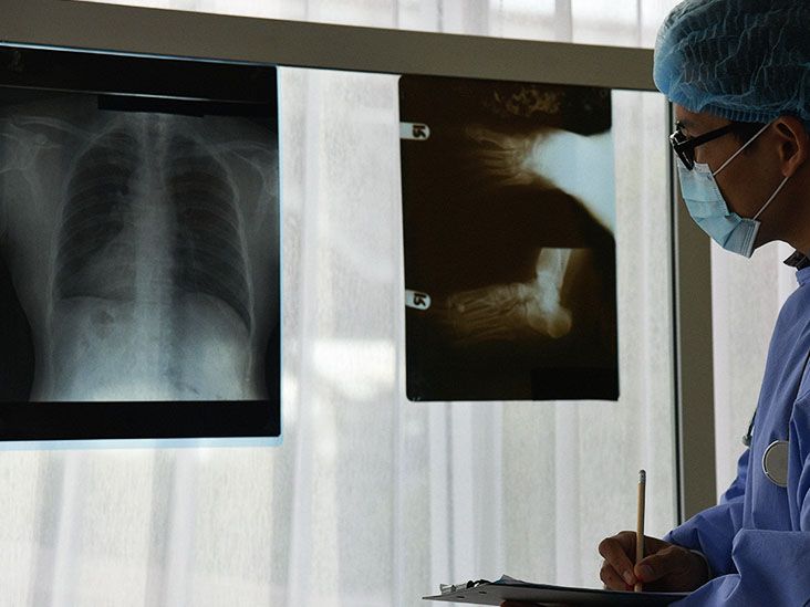 Autoimmune pericarditis: Definition, symptoms, and more